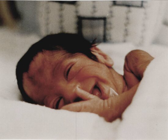 Welcome! - Neonatology on the Web