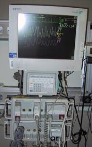 Equipment in the NICU – Neonatology on the Web